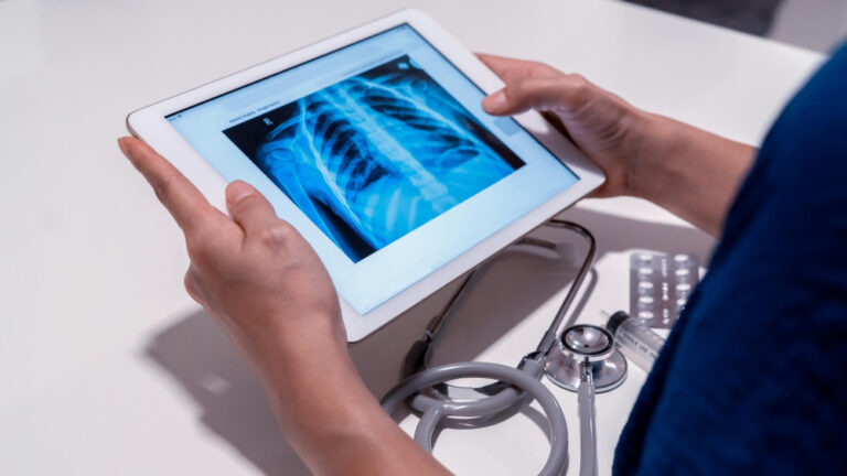 What is Digital X-Ray and How Does It Differ from Traditional X-Rays ...